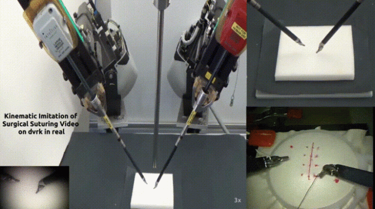 Google And Intel Launch Robotic Surgeons That Learn From Videos